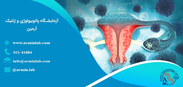 تفاوت عفونت ادراری و بیماری مقاربتی آزمایشگاه آرمین آزمایش Hpv