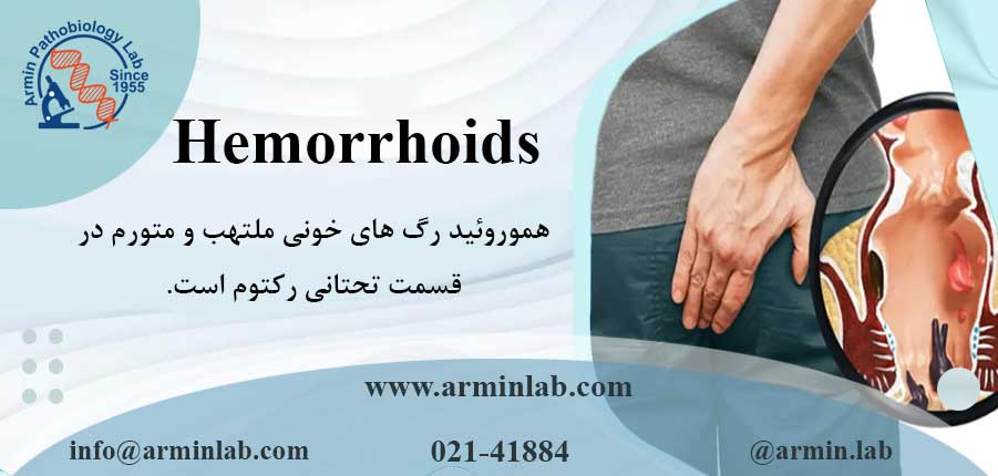 هموروئید | آزمایشگاه آرمین | بیماری های گوارشی