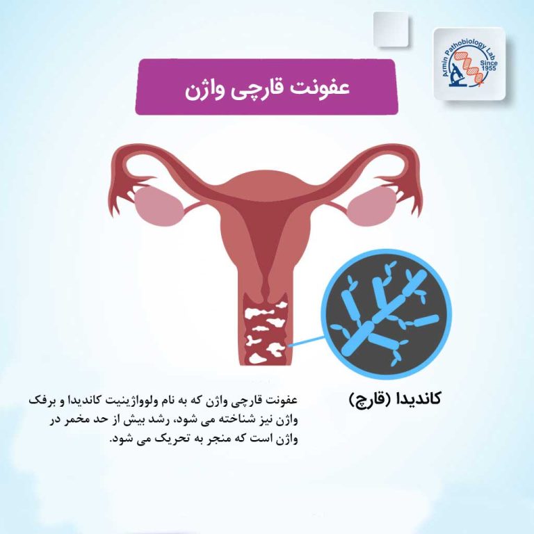 تفاوت علائم Std و عفونت قارچی آزمایشگاه آرمین بیماری های مقاربتی